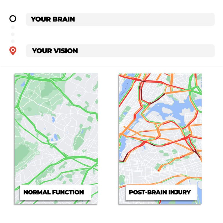 The Eye & Brain Connection